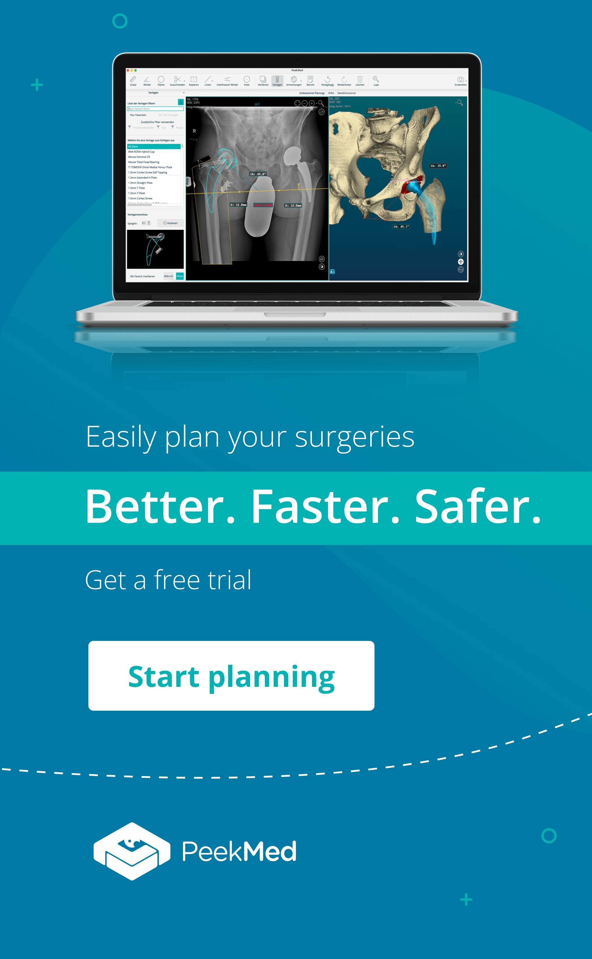 How to do x-ray calibration: from markers to magnification